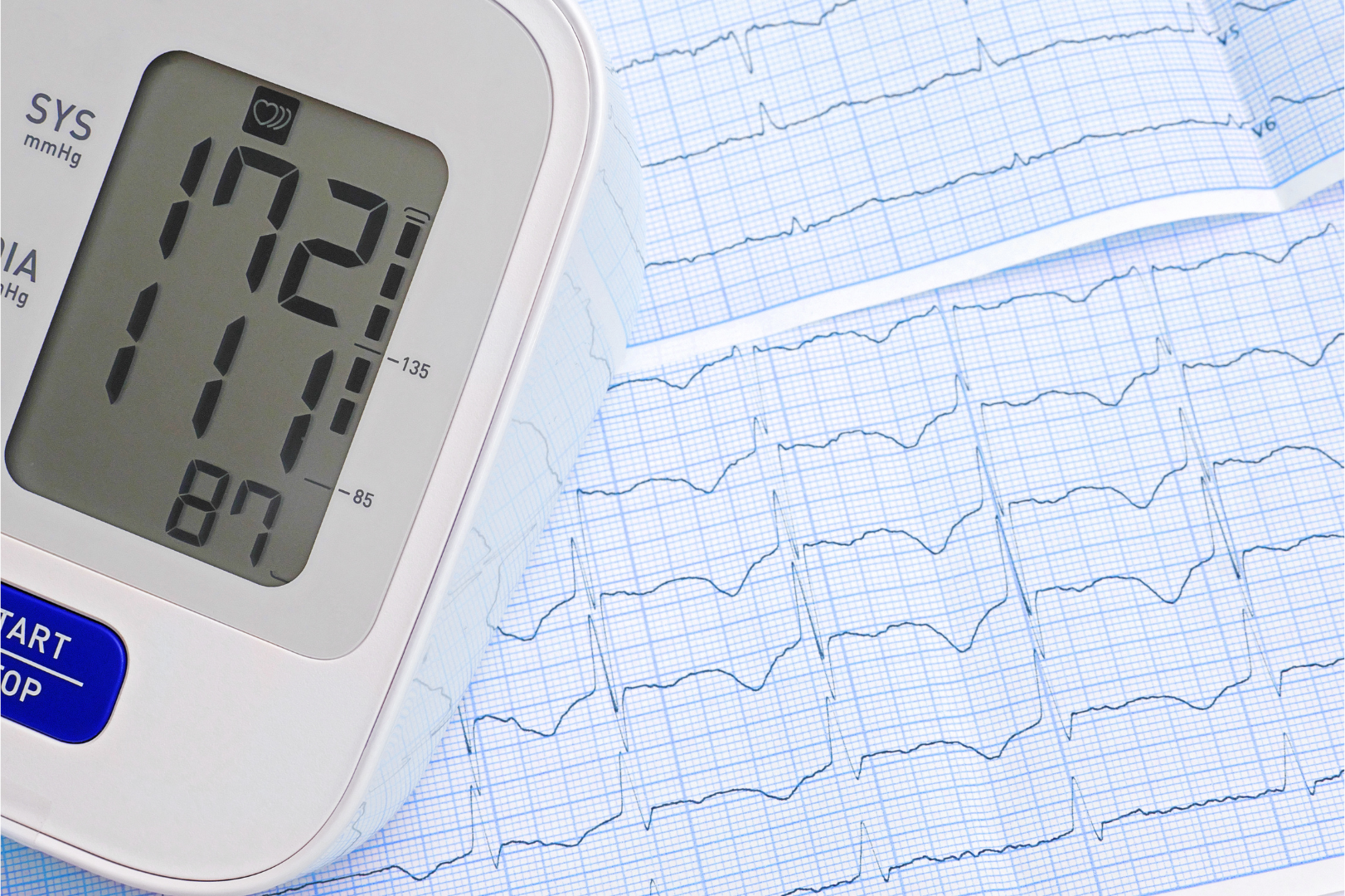 SMARTSHAPE | Continuous monitoring, personalised control